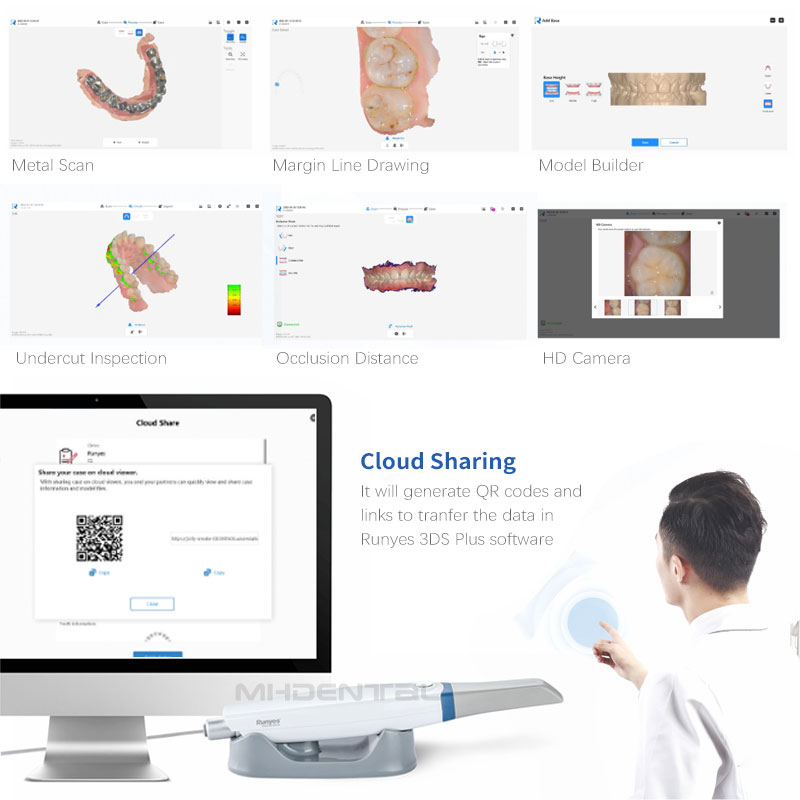 Original Runyes 3DS V3 PRO Digital Dental Intraoral 3D Scanner with ...