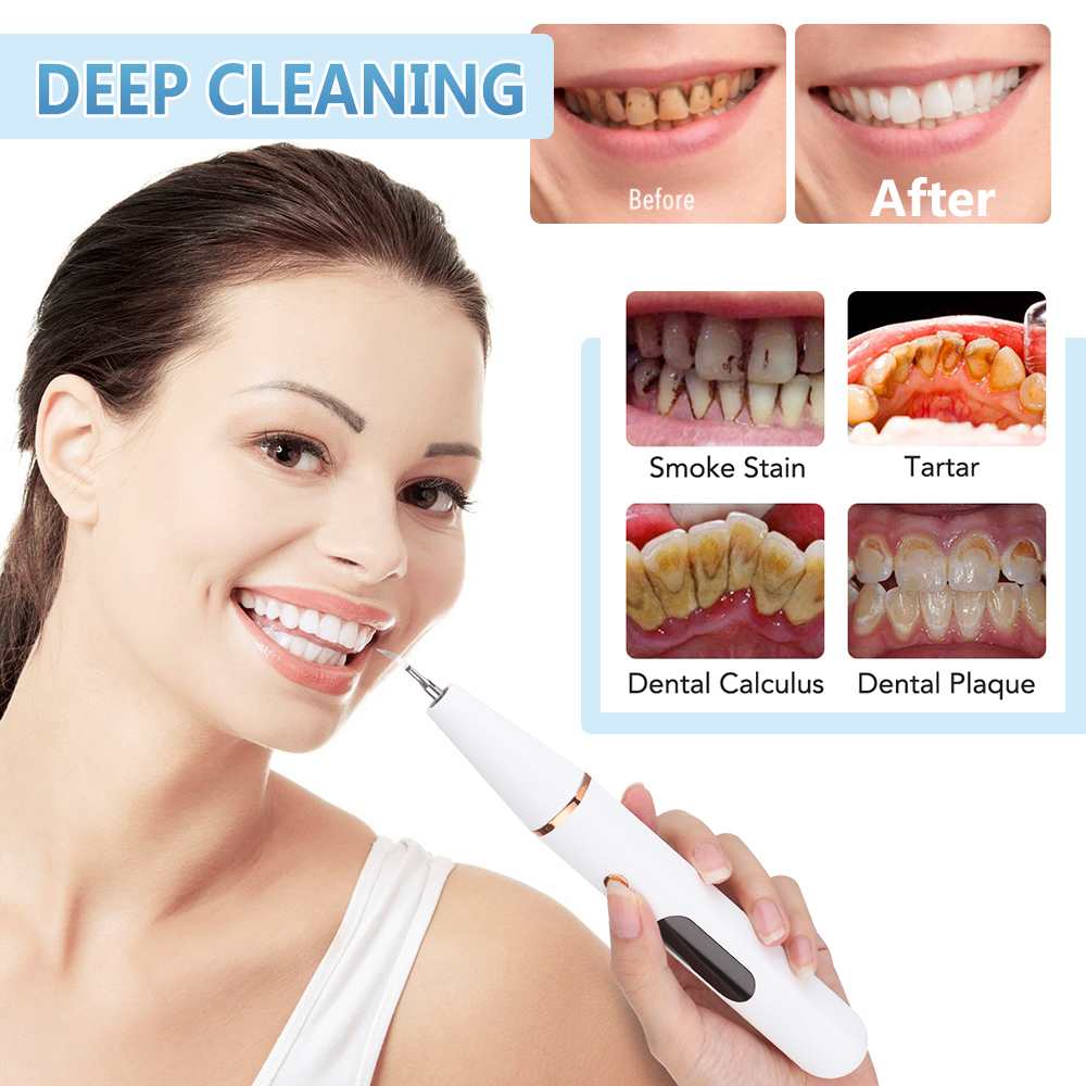 [READY STOCK]LED Ultrasonic Teeth Cleaner for Tooth Stain&Tartar Plaque ...