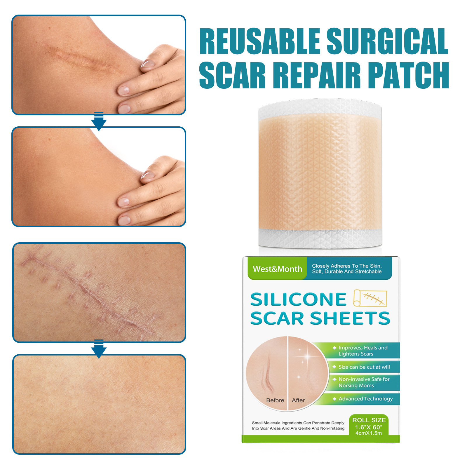 West&Month Silicone Sheets for Scar Repair and Skin Smoothing Lembaran ...