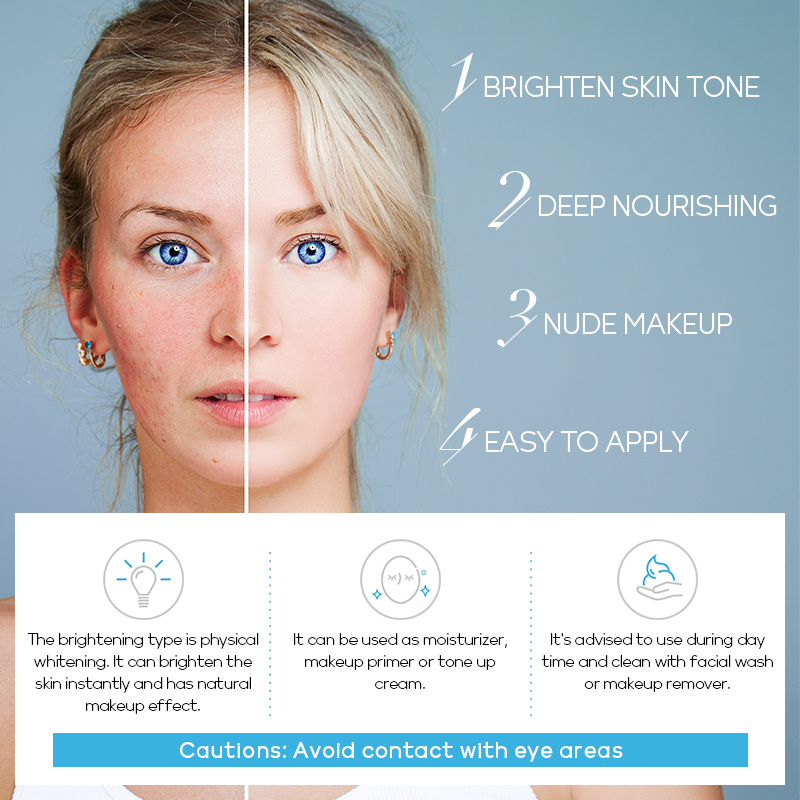 Whitening spot removal cream Niacinamide face cream Light spot ...