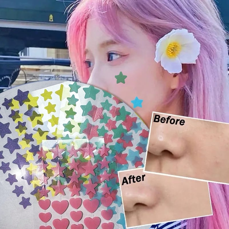 Acne Pimples แผ่นแปะสิว Cute Character Star Heart Butterfly Agne Acne ...
