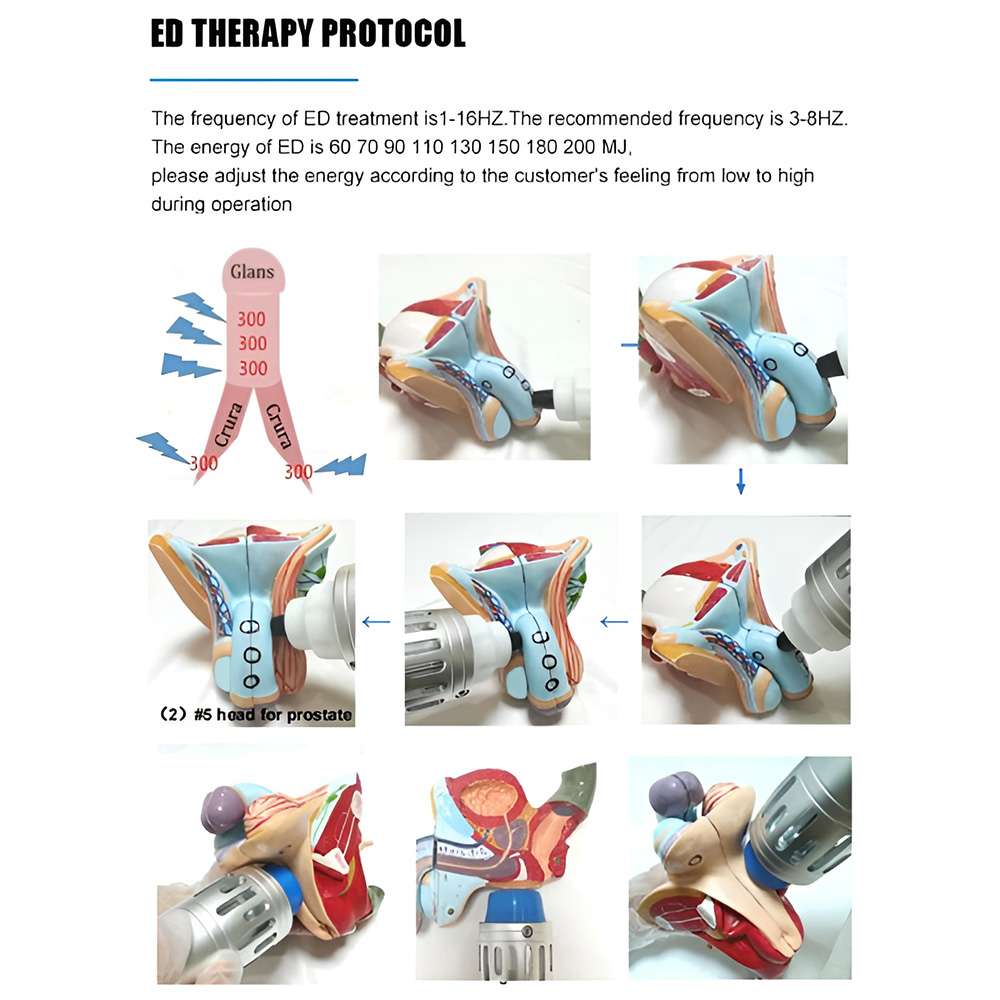 ED Silicone Grey Heads for Shockwave Machines Flat Head Erectile ...