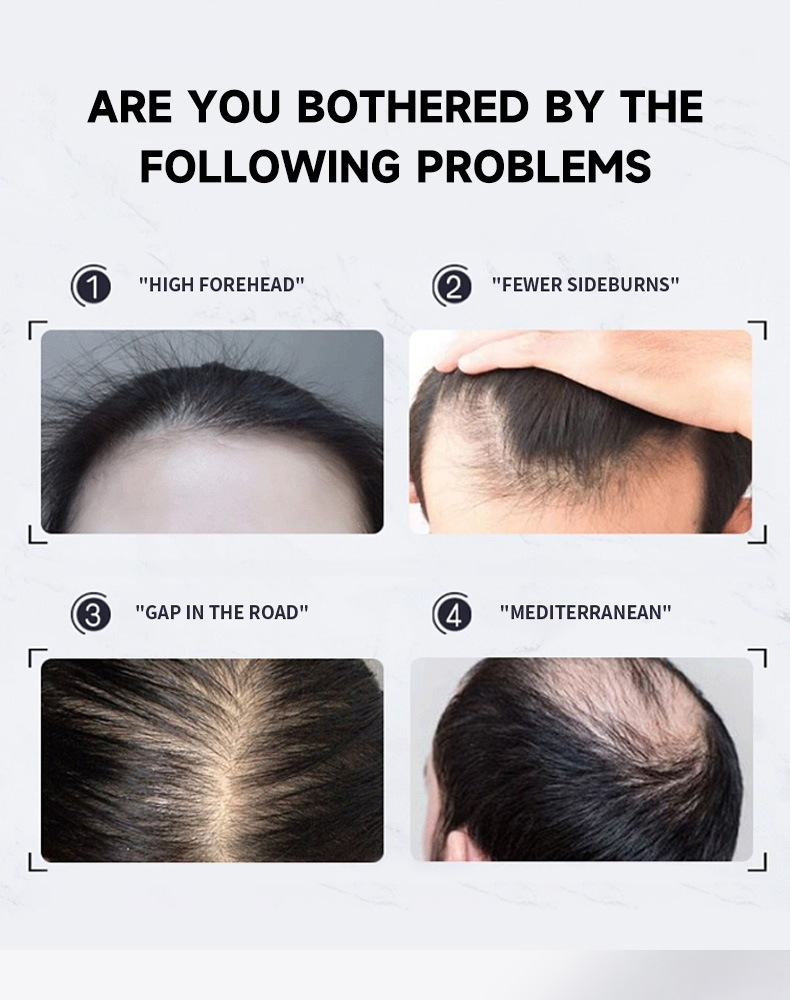 Dr.Medsam Hair Regrowth Treatment Serum, REDENSYL 3% with Biotin , Anti ...