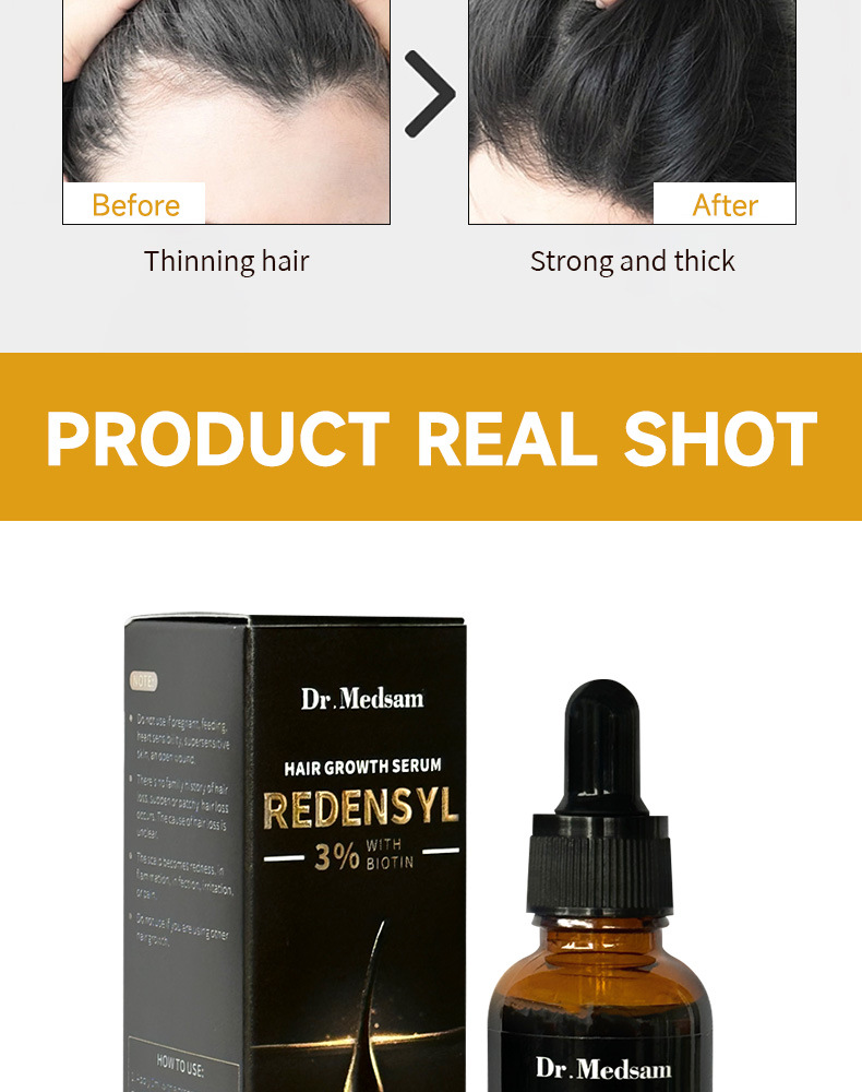 Dr.Medsam Hair Regrowth Treatment Serum, REDENSYL 3% with Biotin , Anti ...