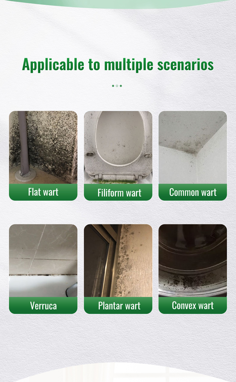 Wall Mold Remover Spray Magic Clean Stain Mildew Toilet Cleaner ...