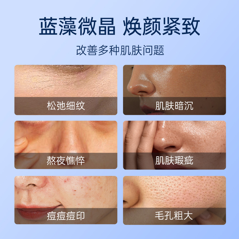 Spirulina Sponge Micro-Needle Upgraded 80% Long Needle Cleaning Sponge ...