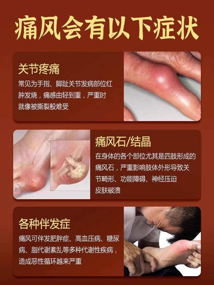 Official genuine gout medical cold compress gel gout joint stiff numb ...