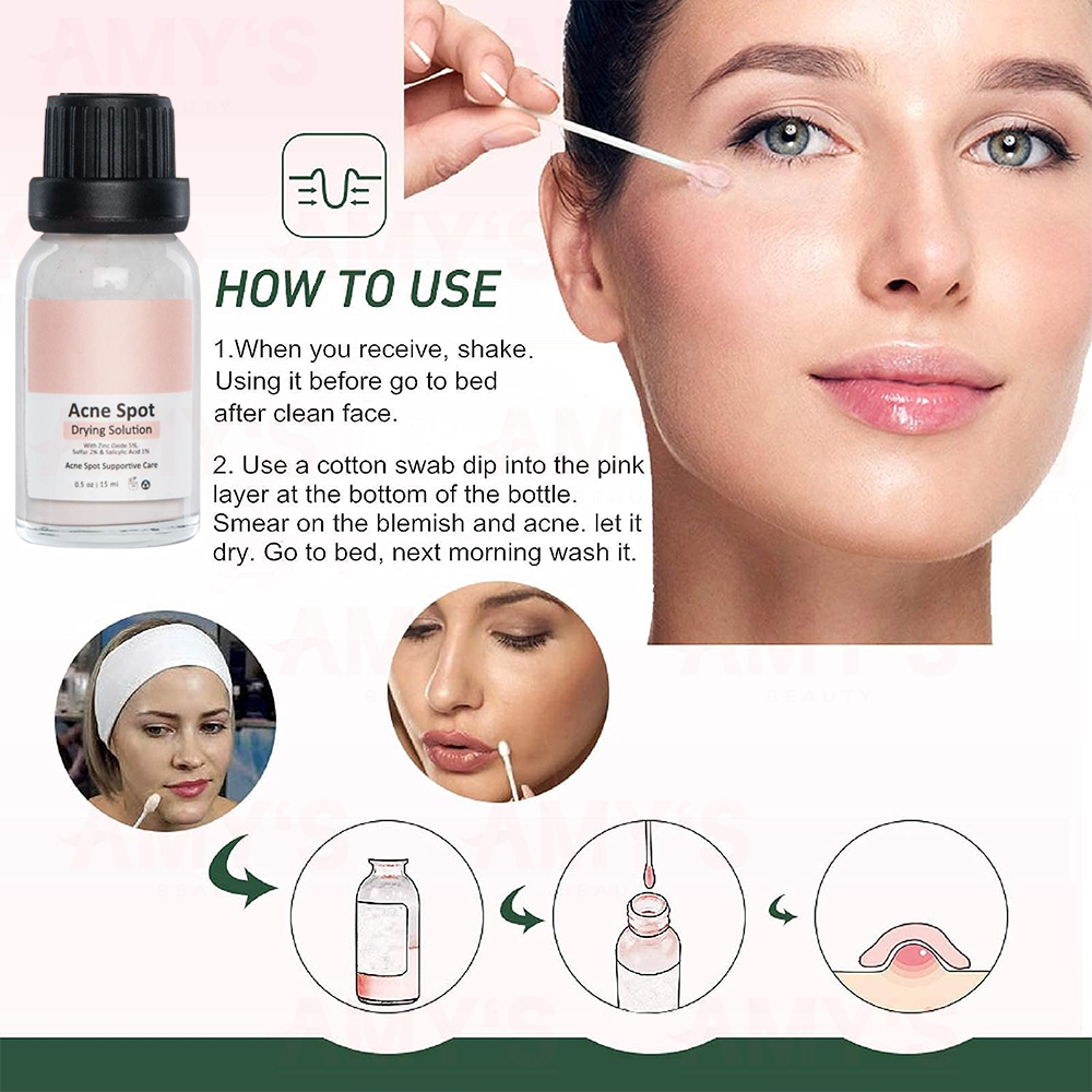 RAW Acne Spot Drying Solution 15/30ml, RAW Acne Care Acne Remover ...