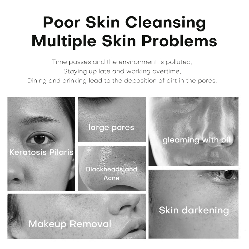 Mineral Mud Mask 100 g Salicylic Acid Mud Mask Pore Cleansing Mud Mask ...