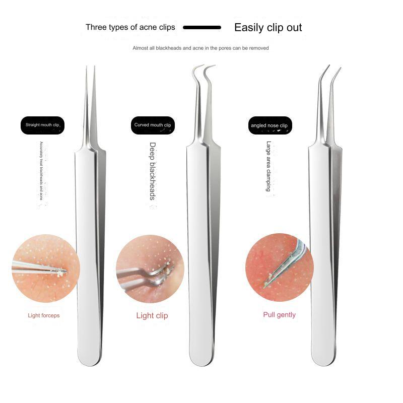 Cell Pimples Blackhead Clip Tweezers Beauty Salon Special Scraping ...