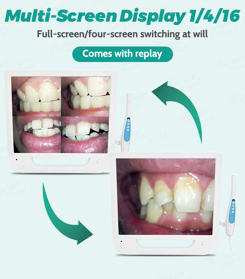 Dental Camera HD 8 Million Pixels High-definition Endoscope Tools 17 ...