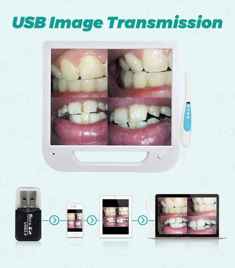 Dental Camera HD 8 Million Pixels High-definition Endoscope Tools 17 ...