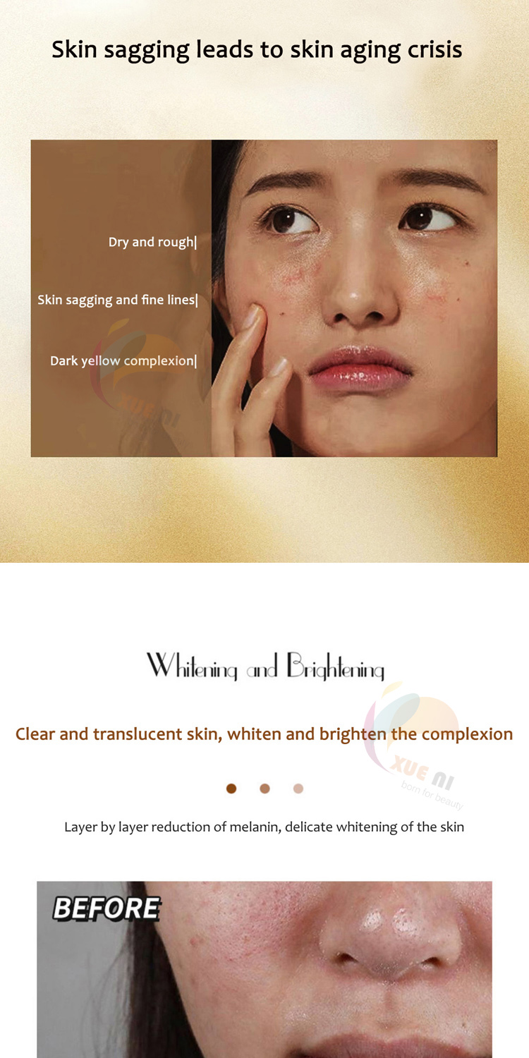 Official Authentic French Su Xiao Anne Living Yeast Lady Cream ...