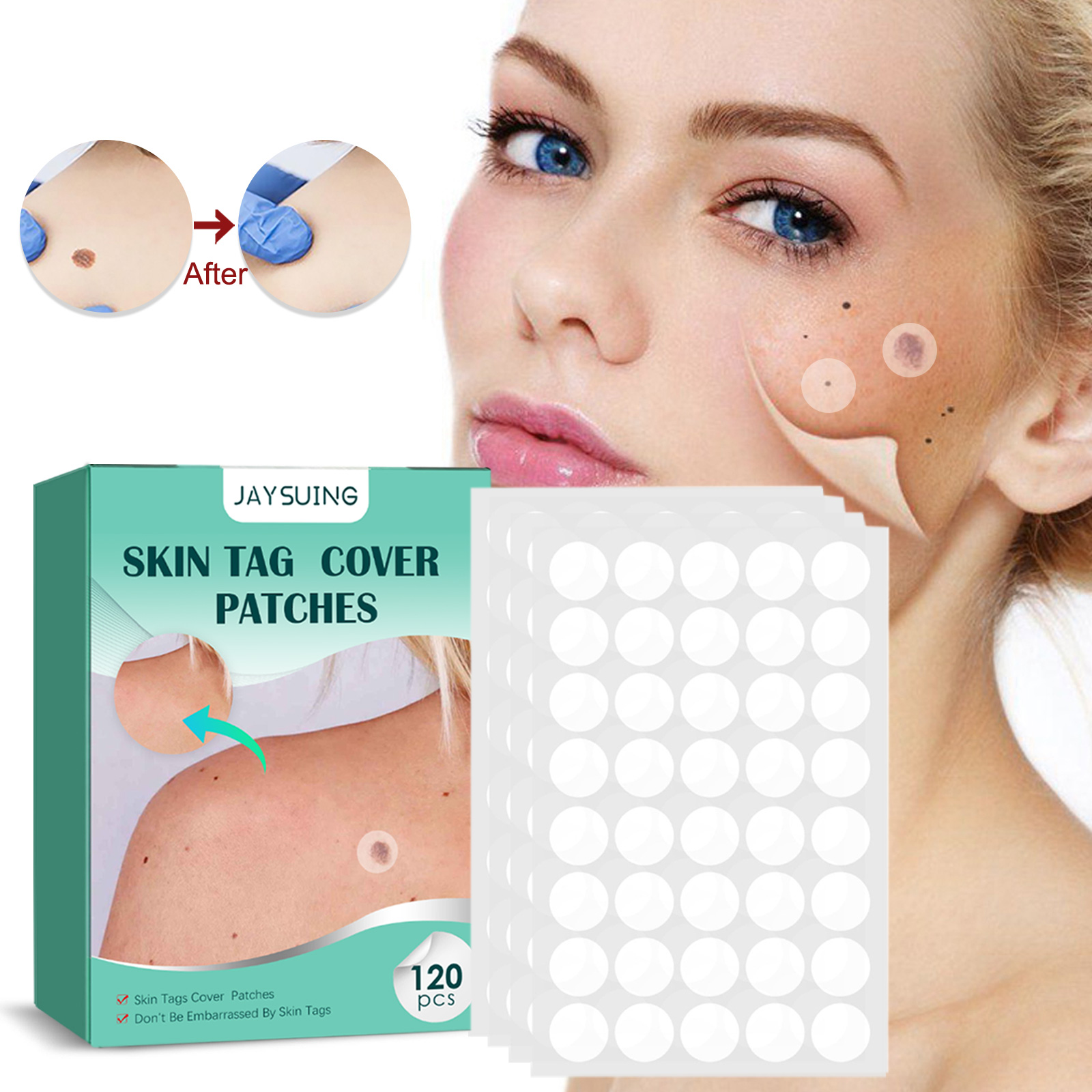 Patch to repair warts soften the skin lighten the face dark moles ...