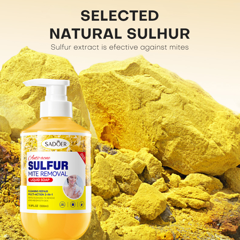 acne body wash Sulfur Acne Anti mite back acne body wash 500ml Eczema ...