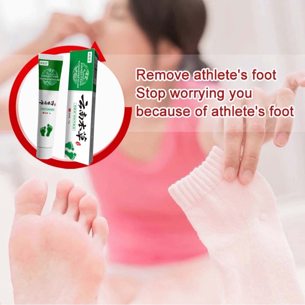 Stop itching immediately Ubat kulat air kaki Eczema Cream Plant formula ...