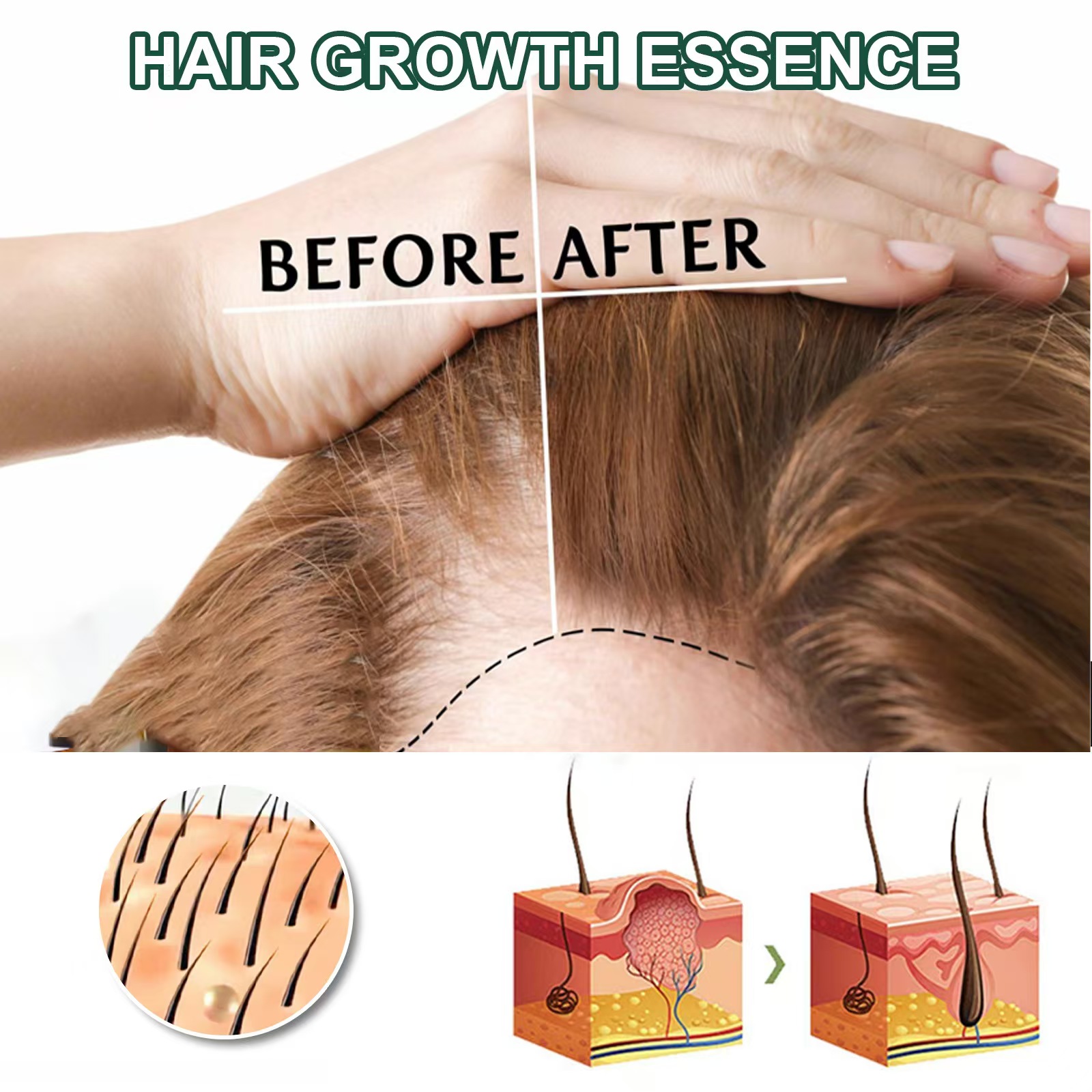 Ginger Hair Growth Spray Strong and Repair Hair Roots Hair Care and ...