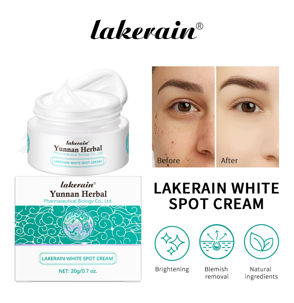 Lakerain Melasma Cream White Spot Cream Whitening Freckle Cream Remove ...