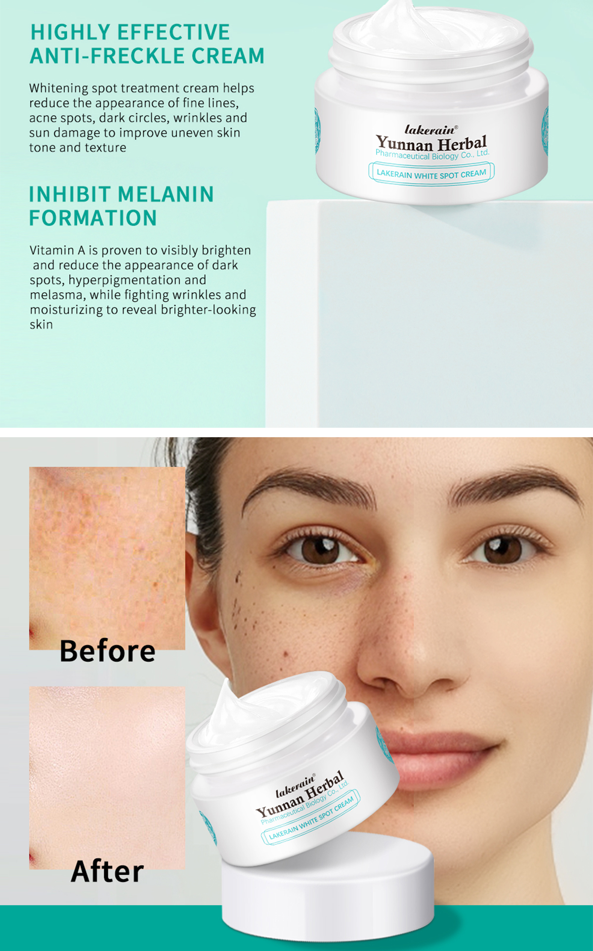 Lakerain Melasma Cream White Spot Cream Whitening Freckle Cream Remove ...