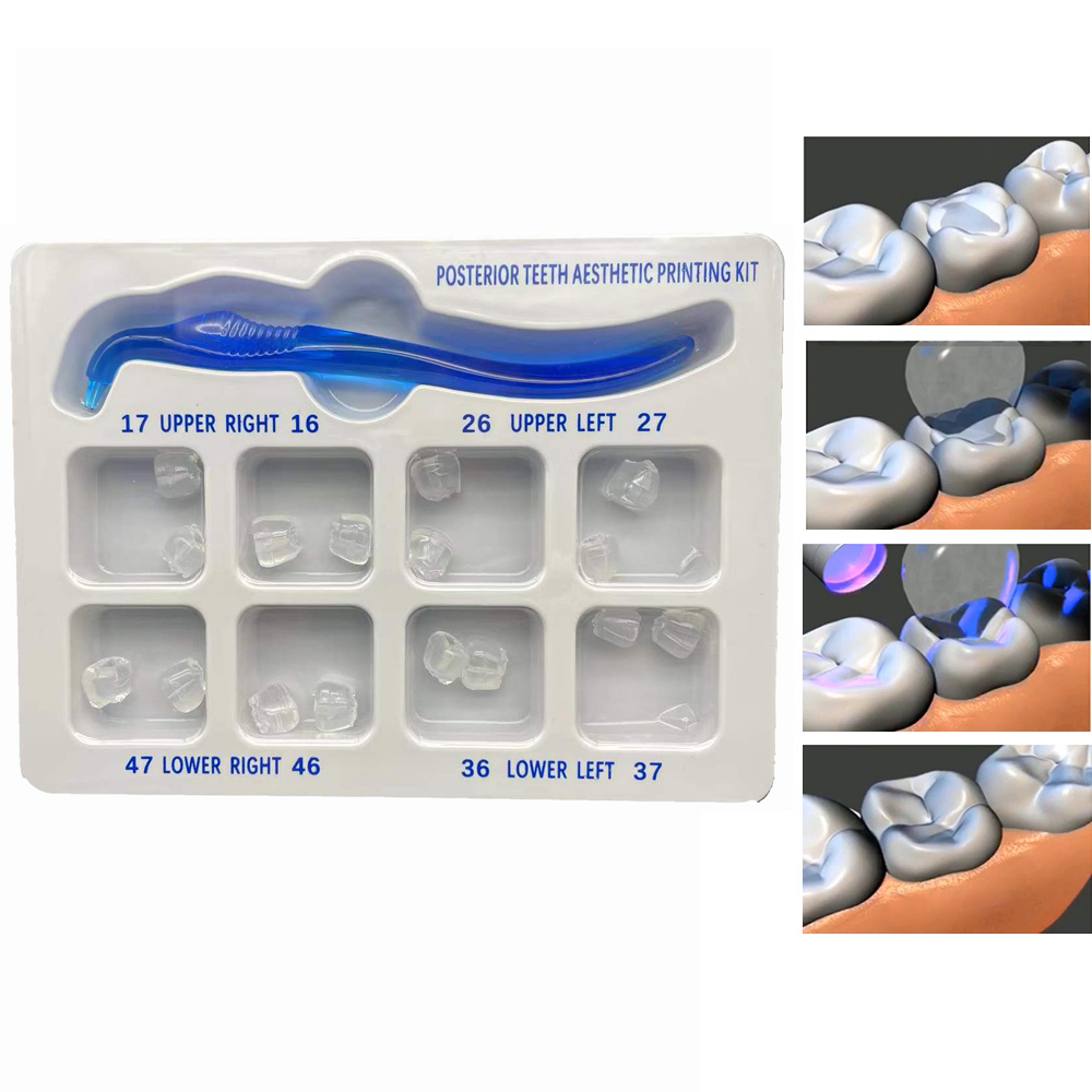 Dental Mould Veneer Kit Anterior Front Teeth Partner Kit Posterior ...