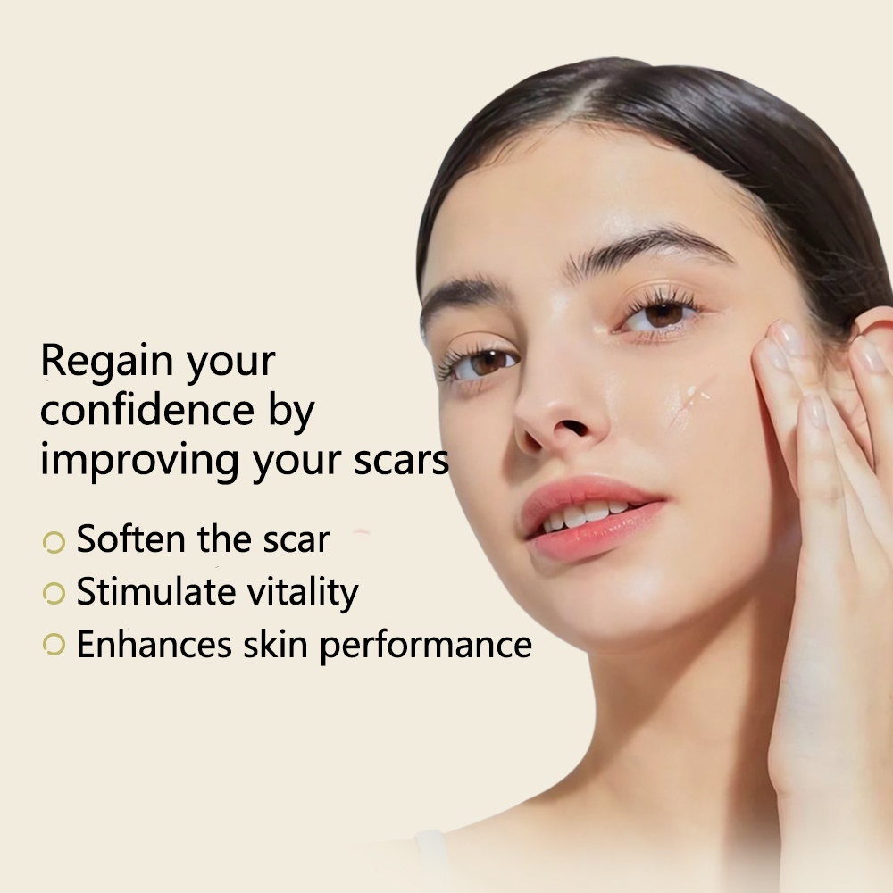 [Hot-selling genuine product] peimei scar cream removes acne marks1 ...