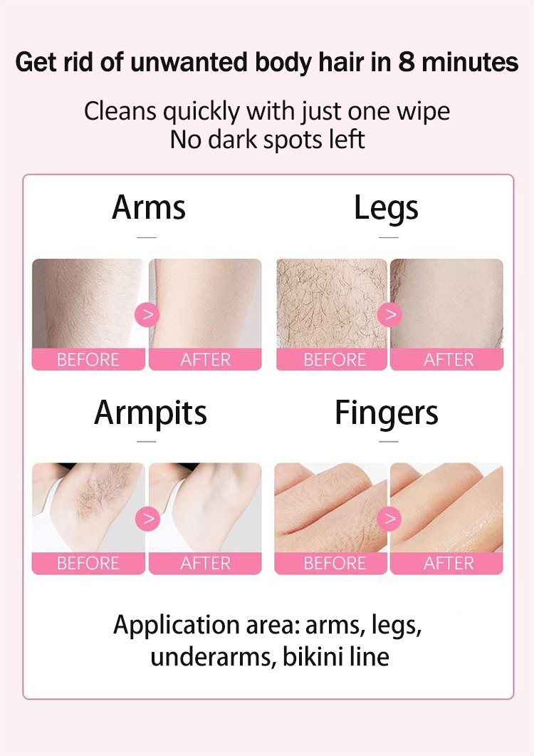 【Hot-selling product】 Lanning hair removal mousse spray hair removal ...