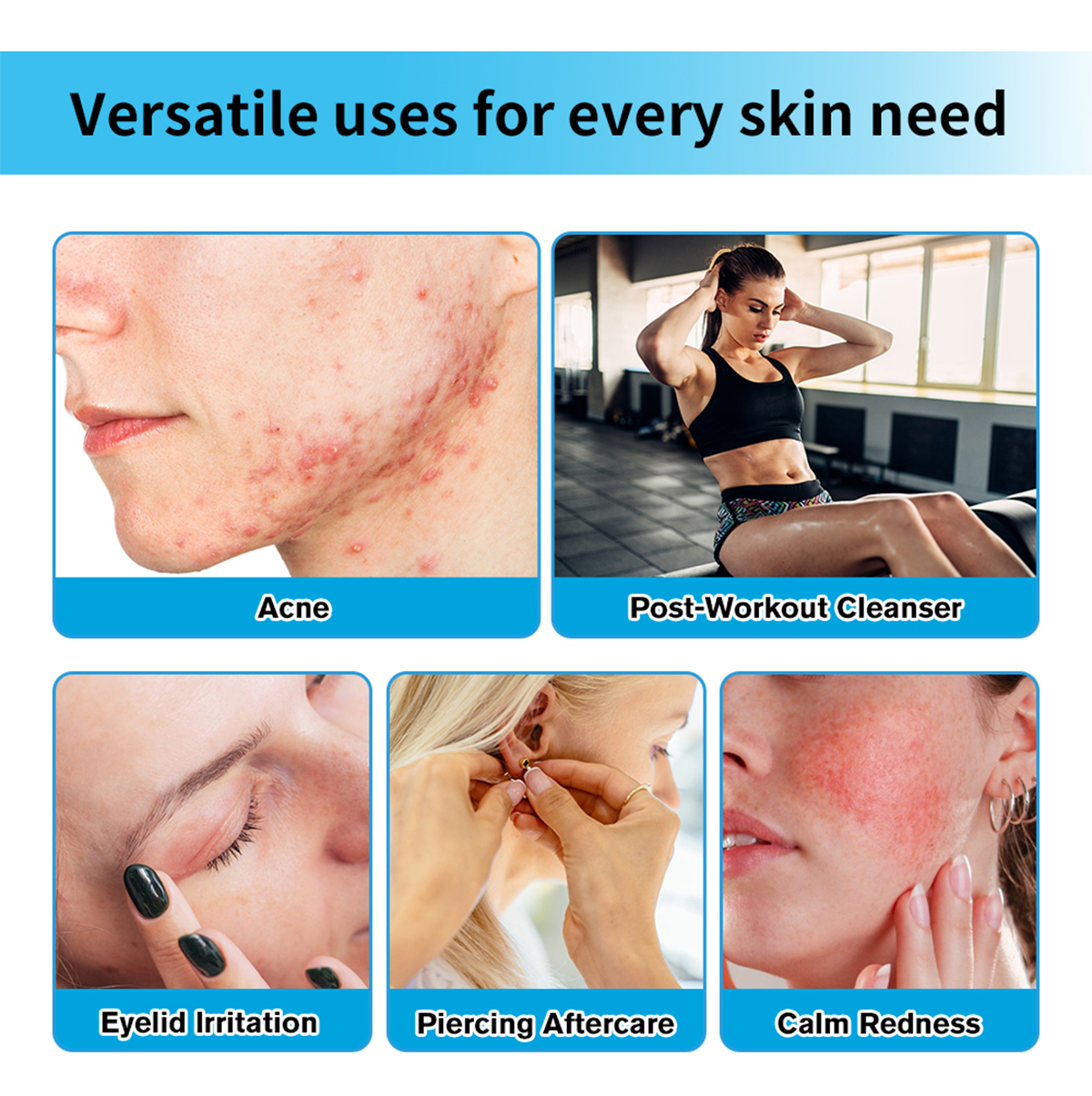 Lakerain 60ml Daily Rescue Facial Spray For Sensitive Skin，HypoChlor Spray - Non-Irritating ...