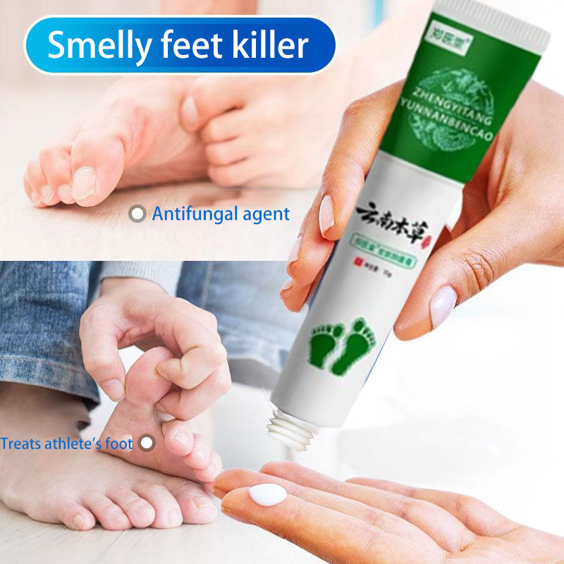 【In stock】Ubat kulat air kaki ubat kaki berbau Kaki mengelupas Foot ...