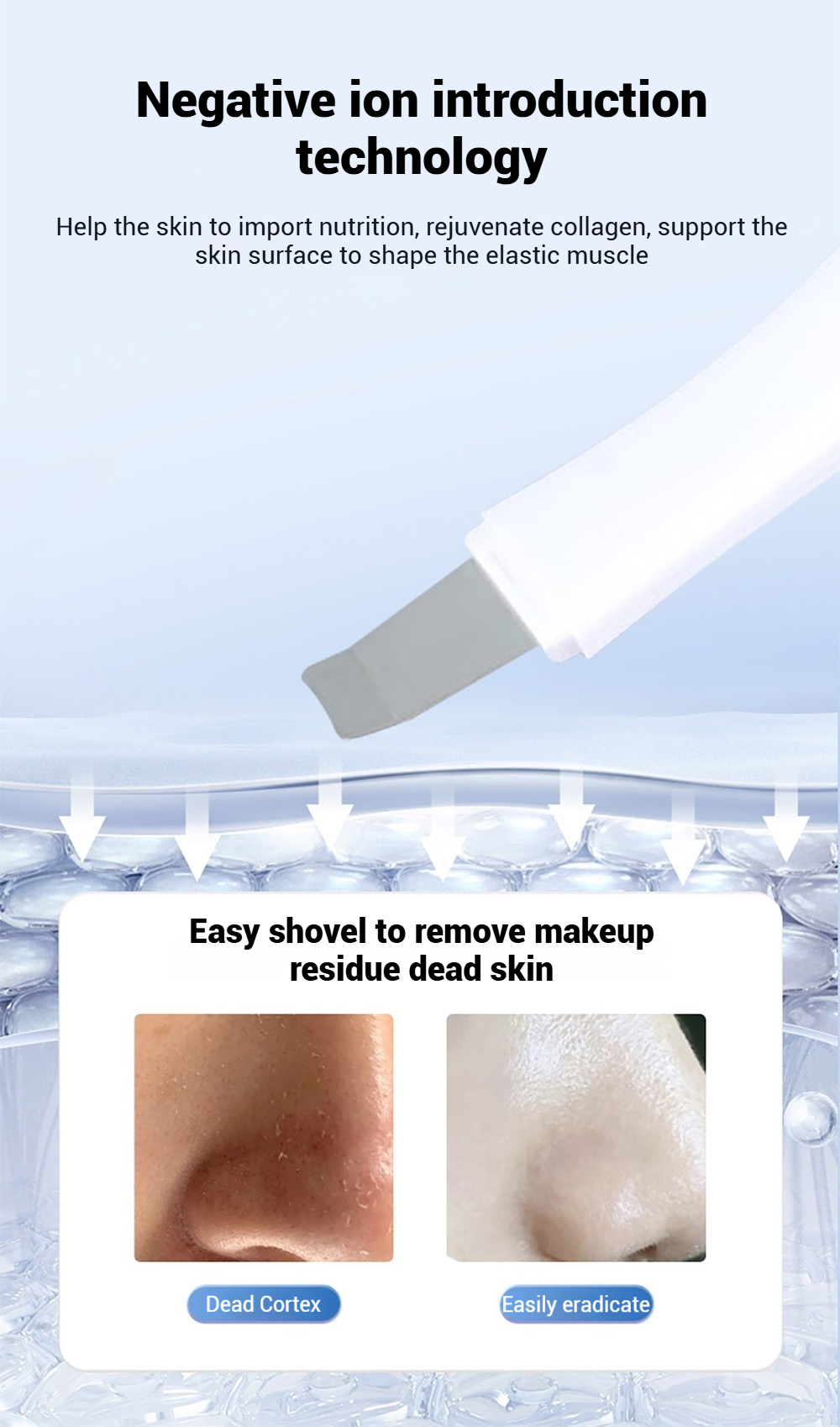 INSMART Ultrasonic Skin Scraper Blackhead Scraper Exfoliating Acne ...