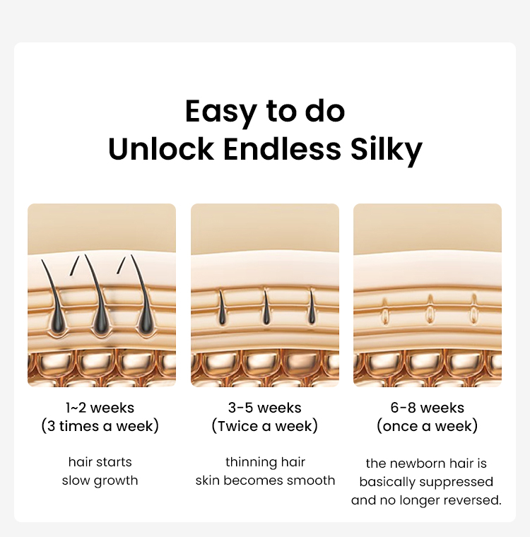 Multifunctional full body hair removal machine, home freezing point ...