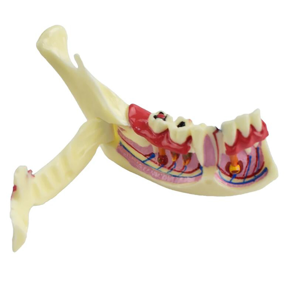 Oral Dental Teaching Mandibular Bone Decomposition Mandible Model ...