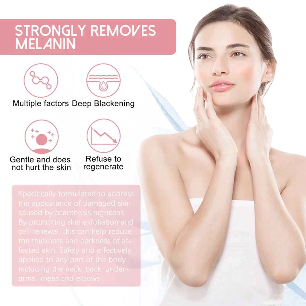 【Official Authentic】armpit private part whitening cream thigh buttock ...