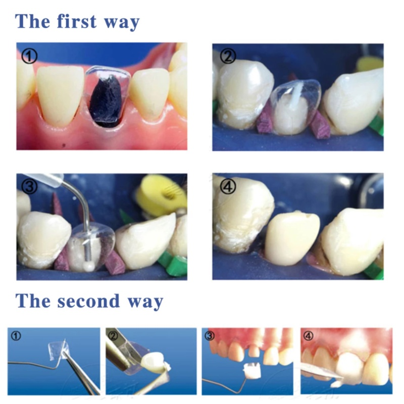 64Pcs Adult Child Dental Transparent Resin Precrown Dental Crown ...
