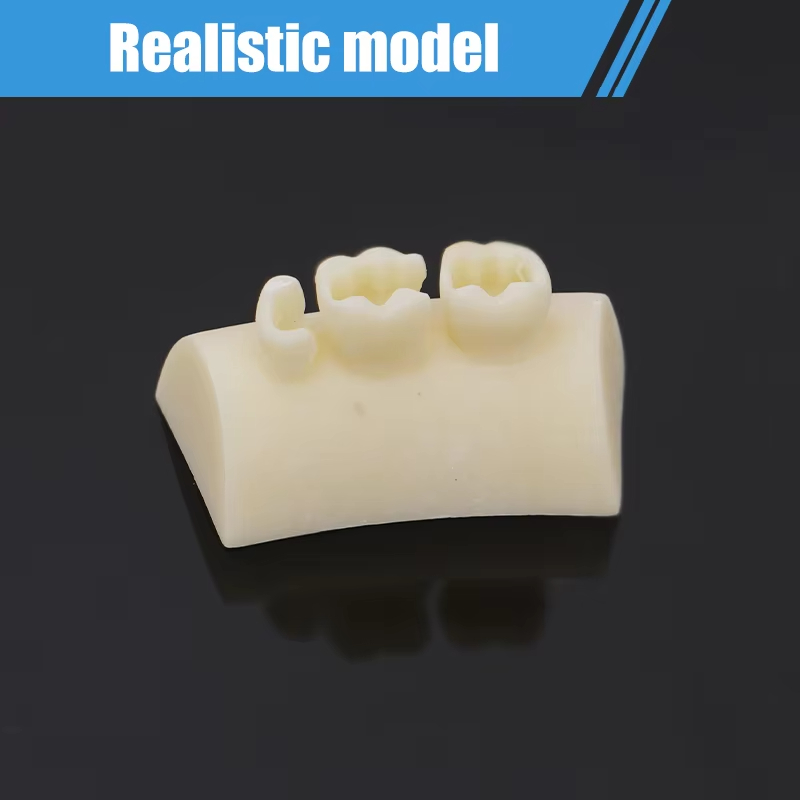 【Ready stock】Dental Inlay Exercise Model Block Composite Resin Filling ...