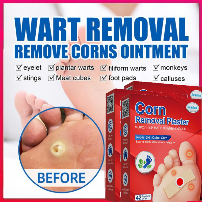 penampal ketuat ubat ketuat Wart Remover Pads Corn Remover 鸡眼贴 42 pcs ...