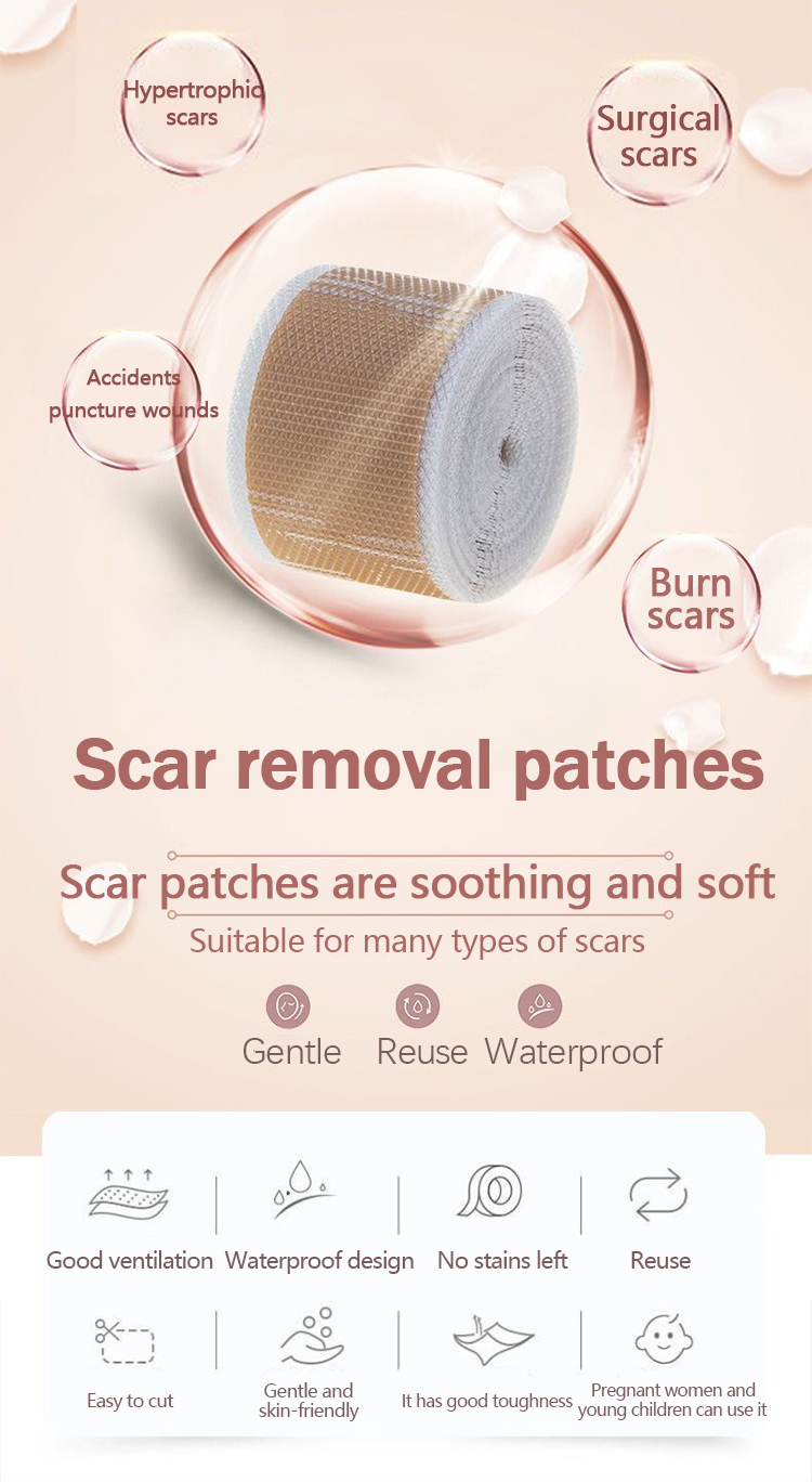 【Selected】Silicone scar patch, scar removal patch, hyperplasia patch ...