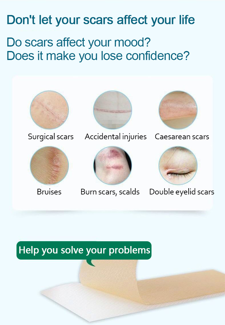 【Selected】Silicone scar patch, scar removal patch, hyperplasia patch ...