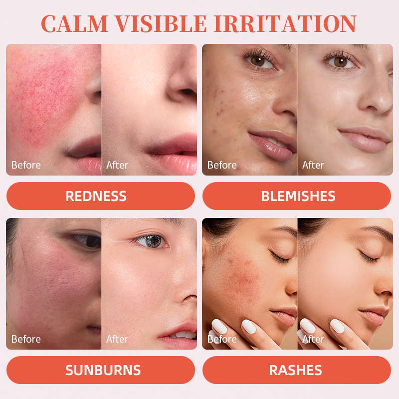 dewyhour Hypochlorous Acid Soothing Protective Spray Soothing And ...