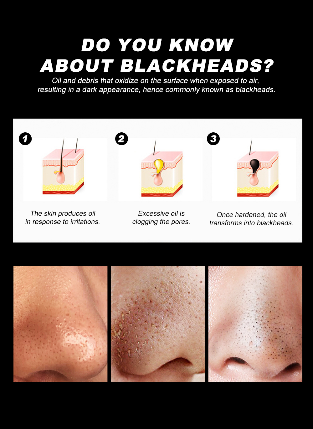 YOUNG VISION Blackhead nose Mask bamboo Charcoal Gentle Tear mask to ...