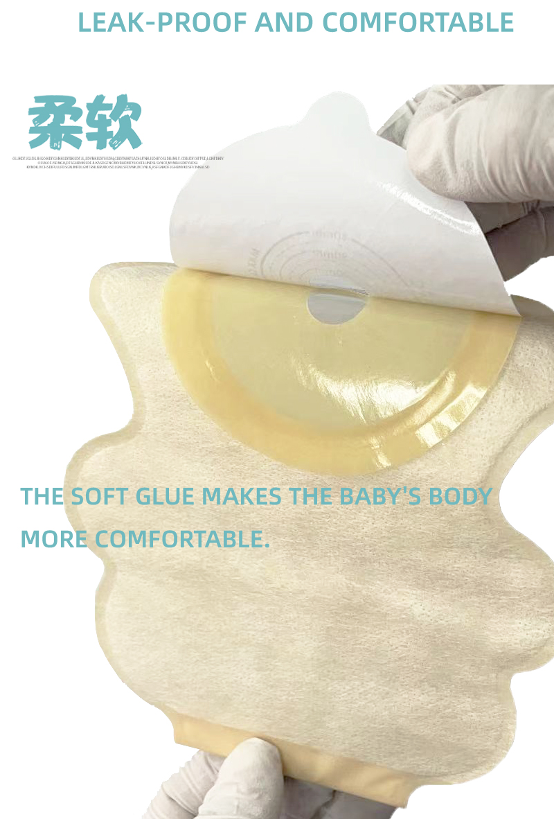 Pediatric 10PCS Children Colostomy Bag, Size 15-40mm Baby mini Ostomy ...