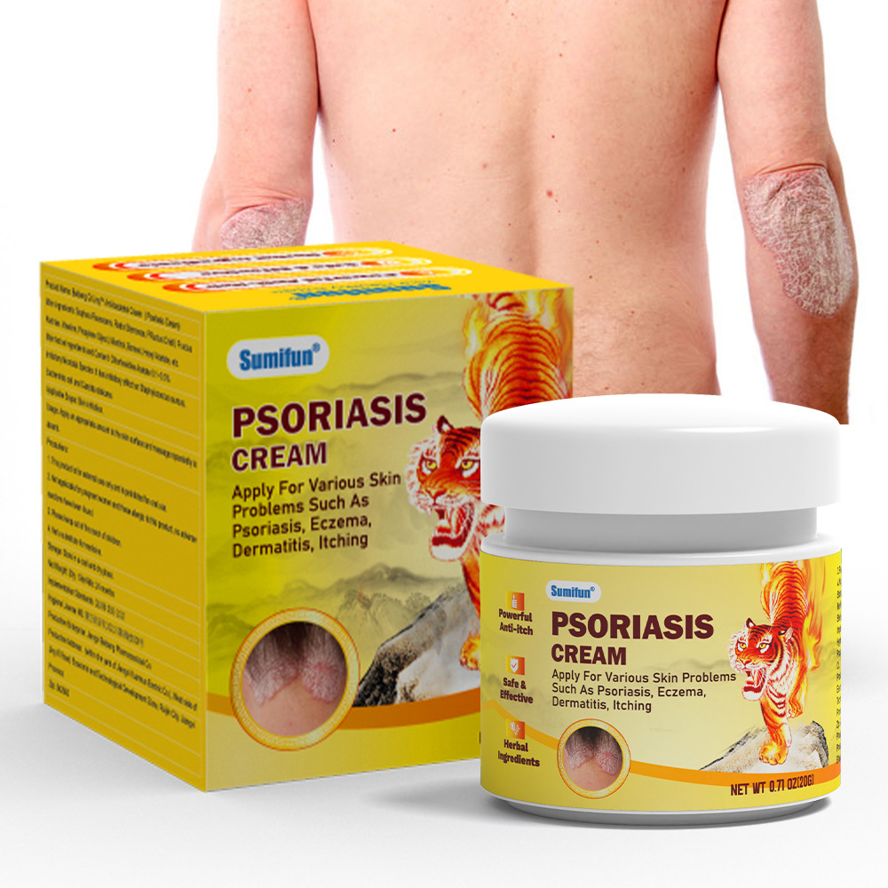 Psoriasis cream 20g for Erythema Ringworm Bacterial Tinea Eczema ...
