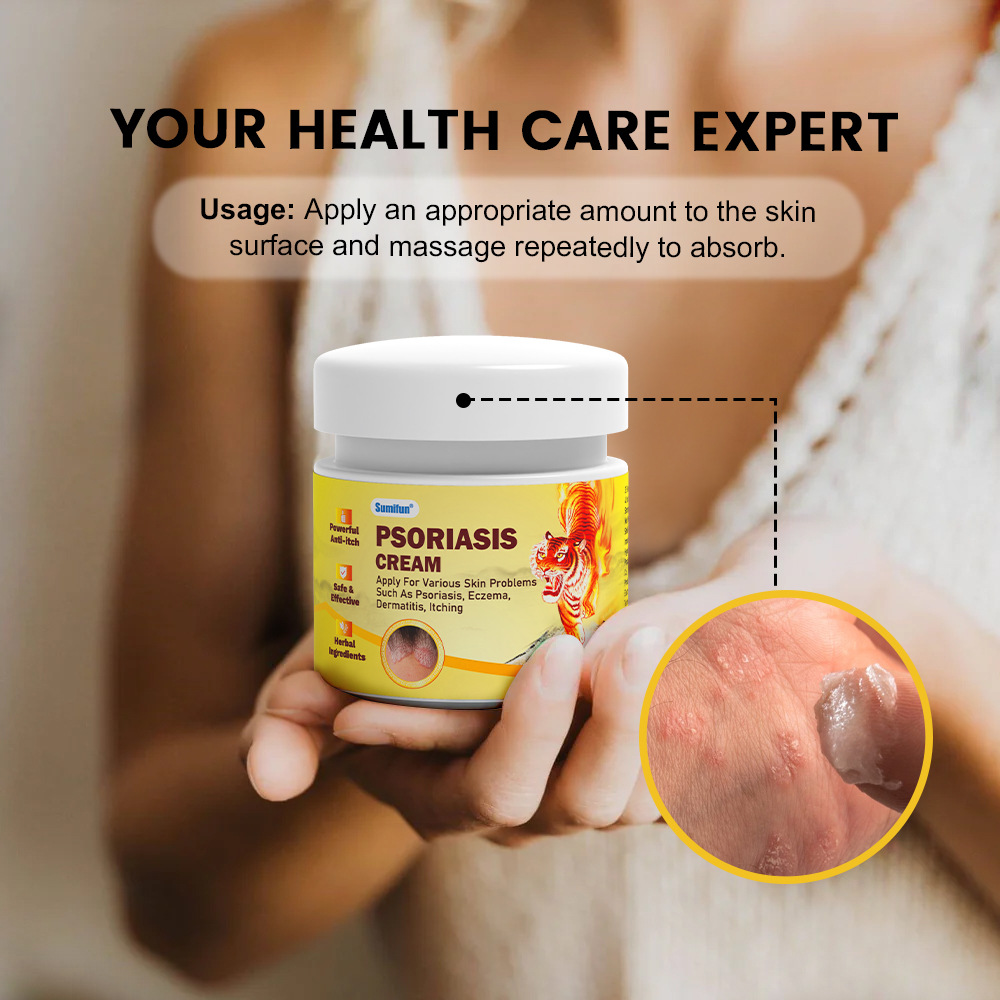 Psoriasis cream 20g for Erythema Ringworm Bacterial Tinea Eczema ...