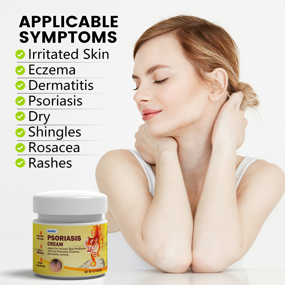 Psoriasis cream 20g for Erythema Ringworm Bacterial Tinea Eczema ...