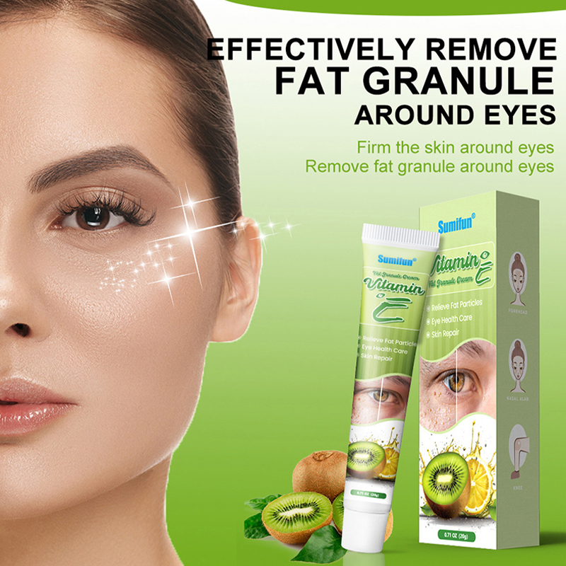 Removing Fat Granules Cream 20g Eye fat particles.fat granules ...