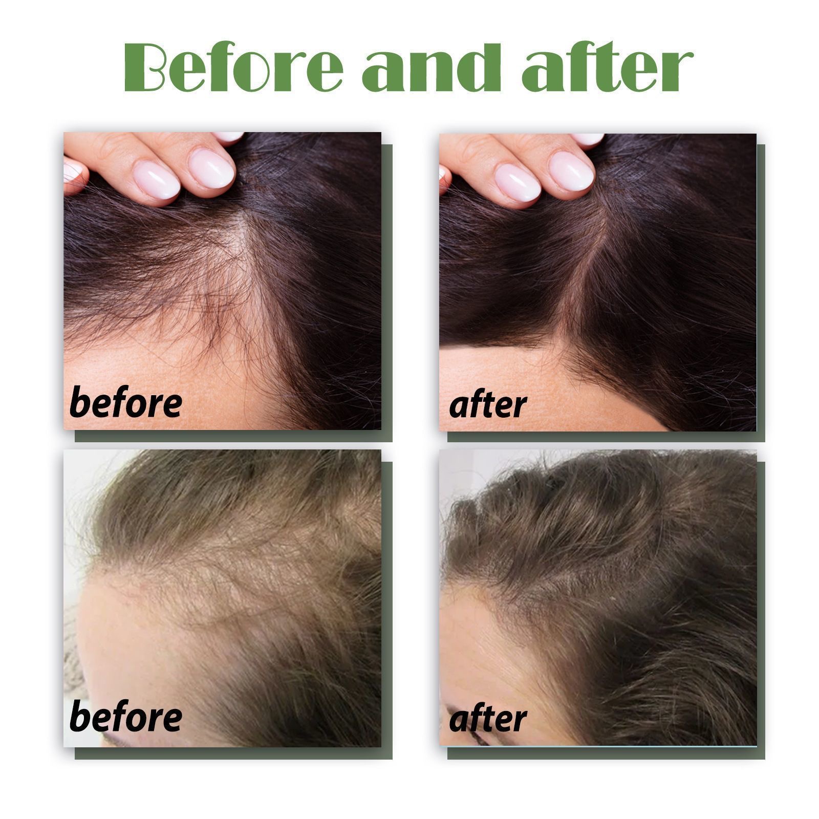 COD Neo Hair Lotion Herbs 100% Natural Treatment Spray Stop Hair Loss ...