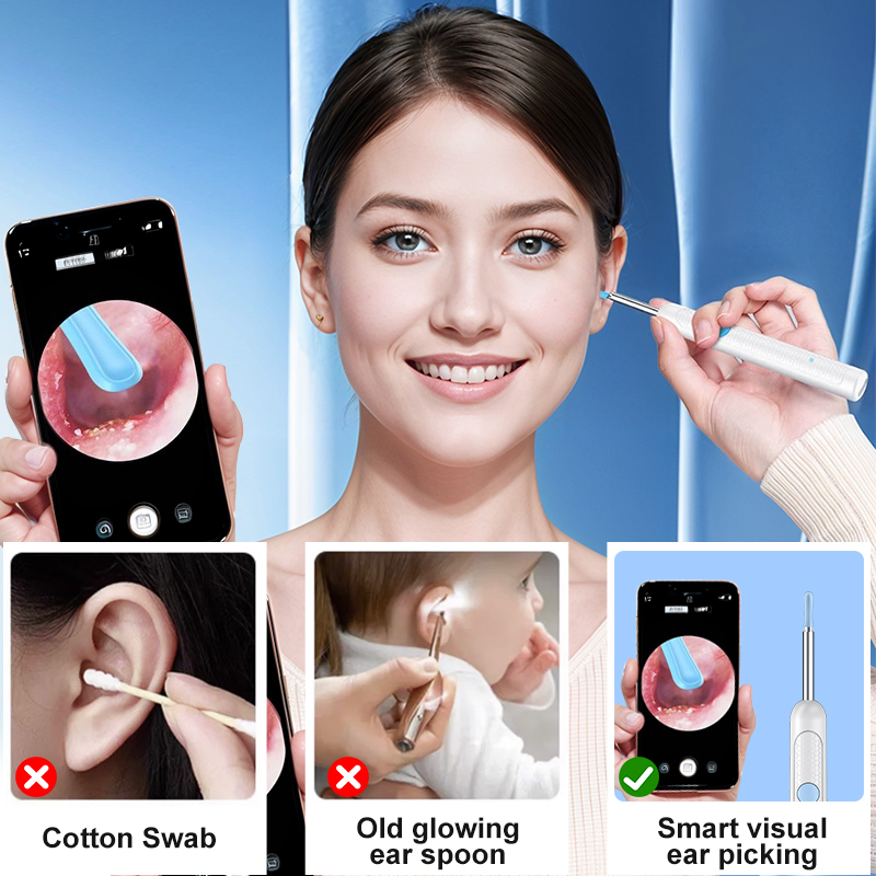CylRedbat 2.5mm Earpick Smart Visual Ear Picker 15-in-1 With Camera For ...