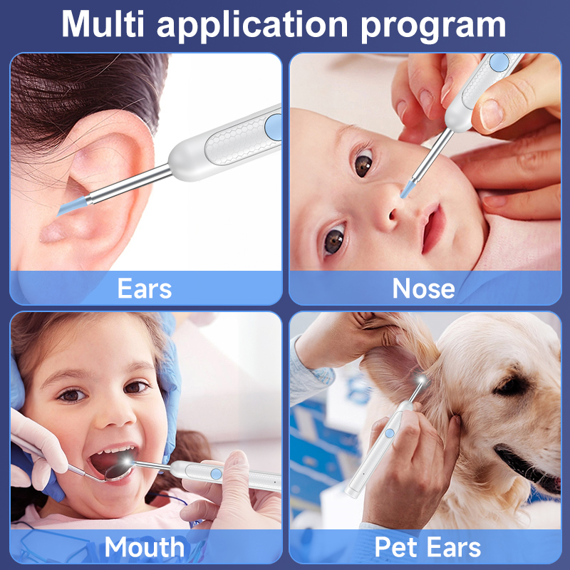 CylRedbat 2.5mm Earpick Smart Visual Ear Picker 15-in-1 With Camera For ...