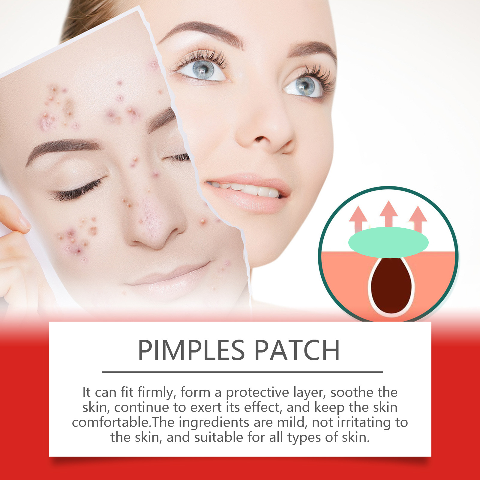 Pimple Patches For Face, Hydrocolloid Acne Pimple Patch For Covering ...