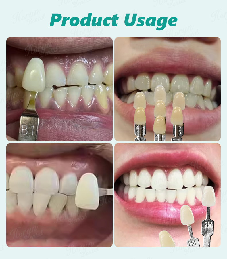 HORYN Dental Bleach Shade Guide 29 Colors VITA 3D Master Teeth ...