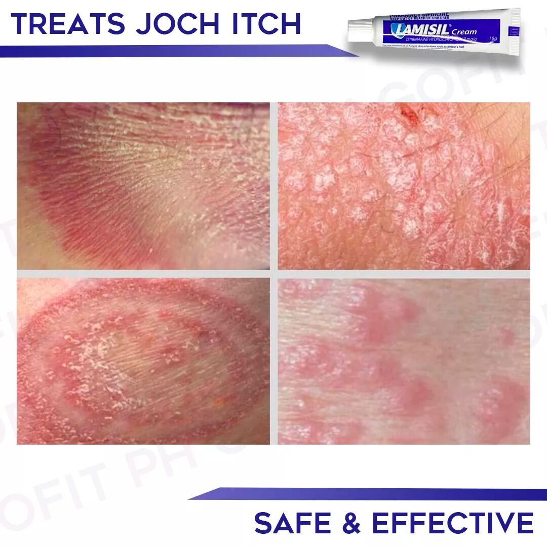 Lamisil Antifungal Ointment Cream for athletes herbal foot care, jock ...